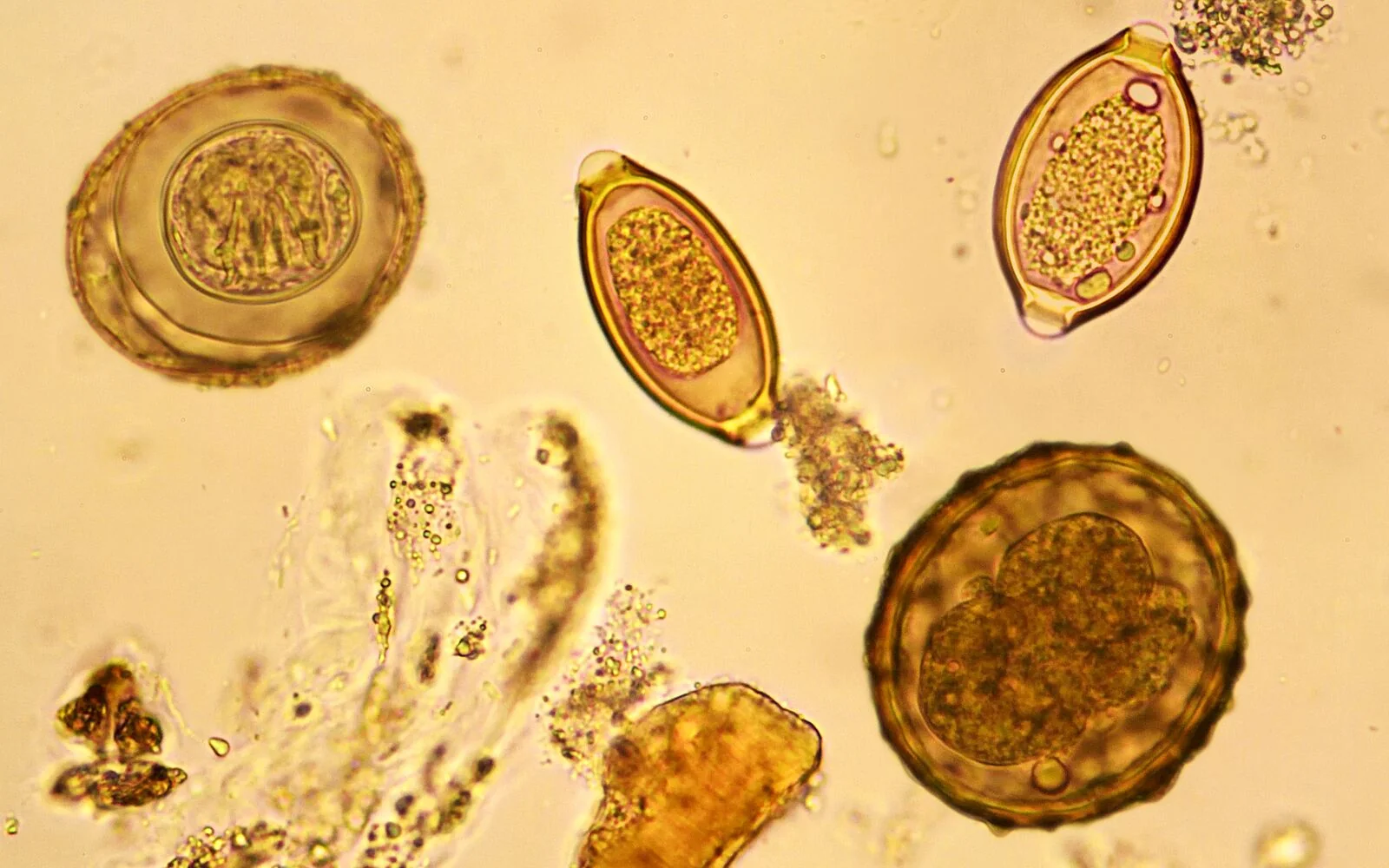 Microbiology Services | Dhruv Diagnostics